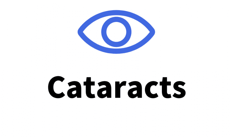 Cataracts - Sight Support West of England