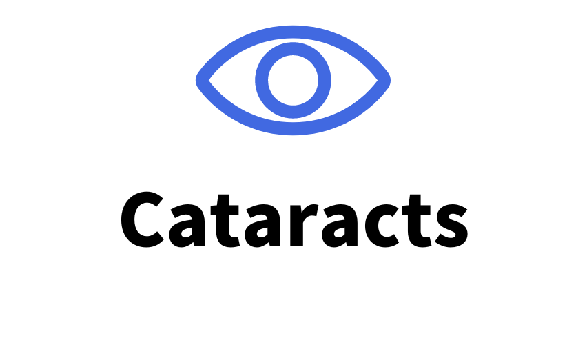 Cataracts - Sight Support West of England